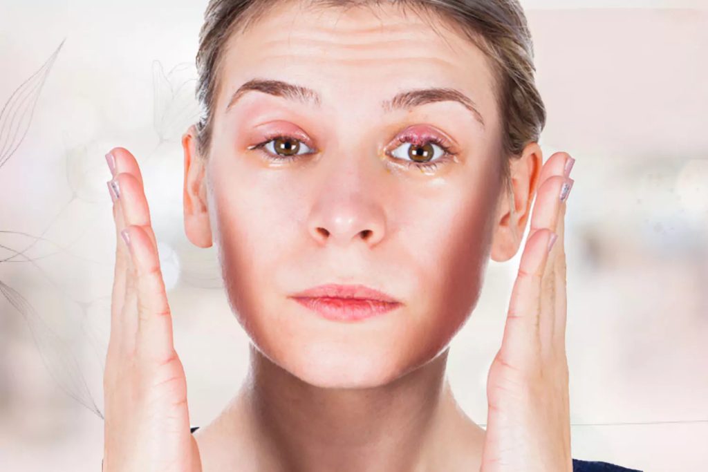 Know If Your Eyelash Follicle Is Damaged: Symptoms & Cure – Yes You Can